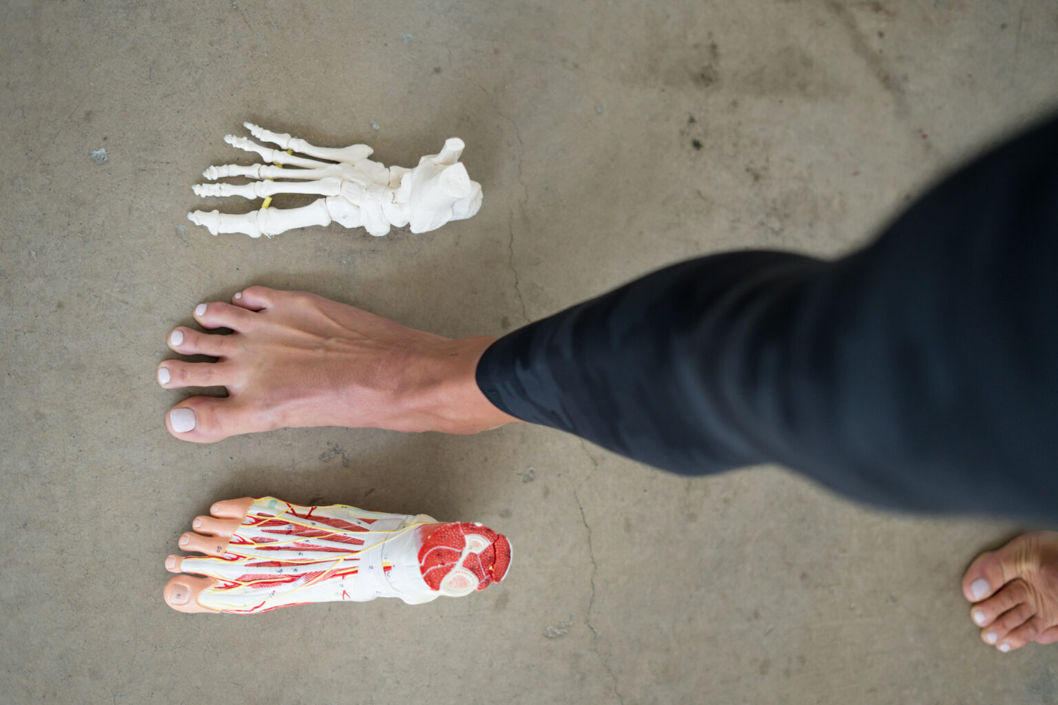 Midfoot Sprains: Causes & Care | Gait Happens